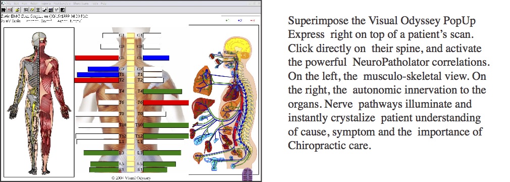 CLA PopUp Upgrade - Neuropatholator
