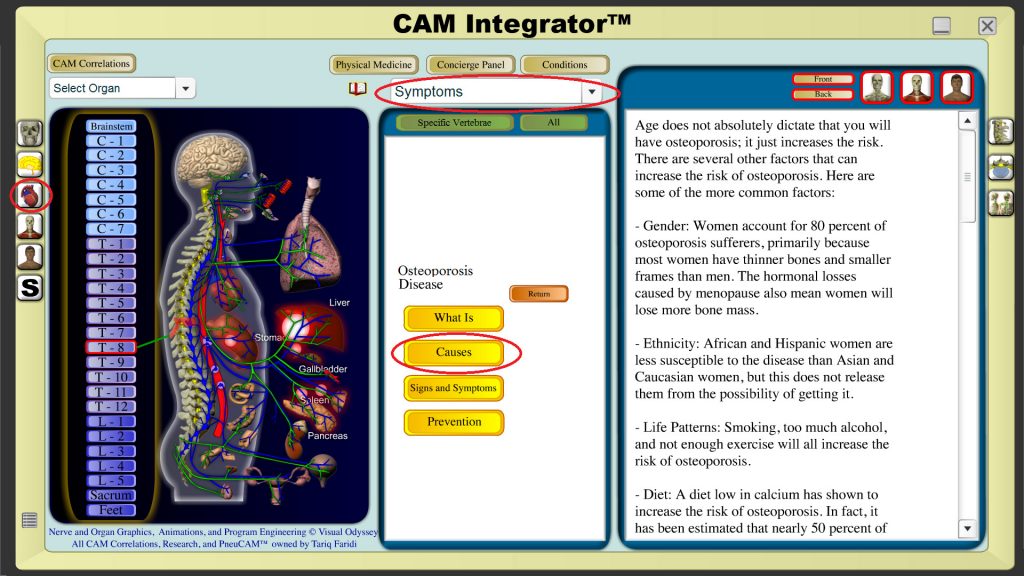 CAM Preview - Neuropatholator